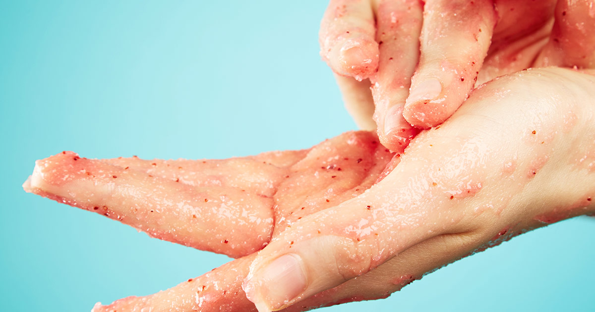 Exfoliation: Slough Years Off Your Skin's Age - MedBroadcast.com